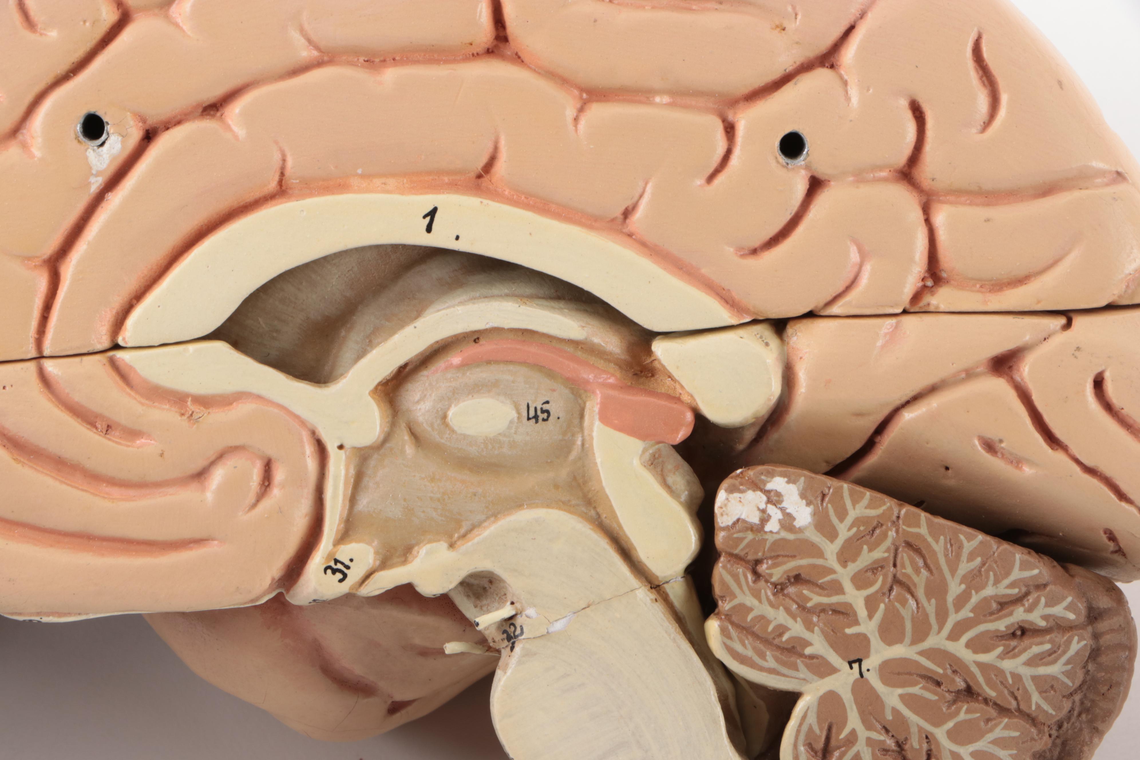 Antique Plaster Four-Piece Anatomical Model of the Human Brain ...