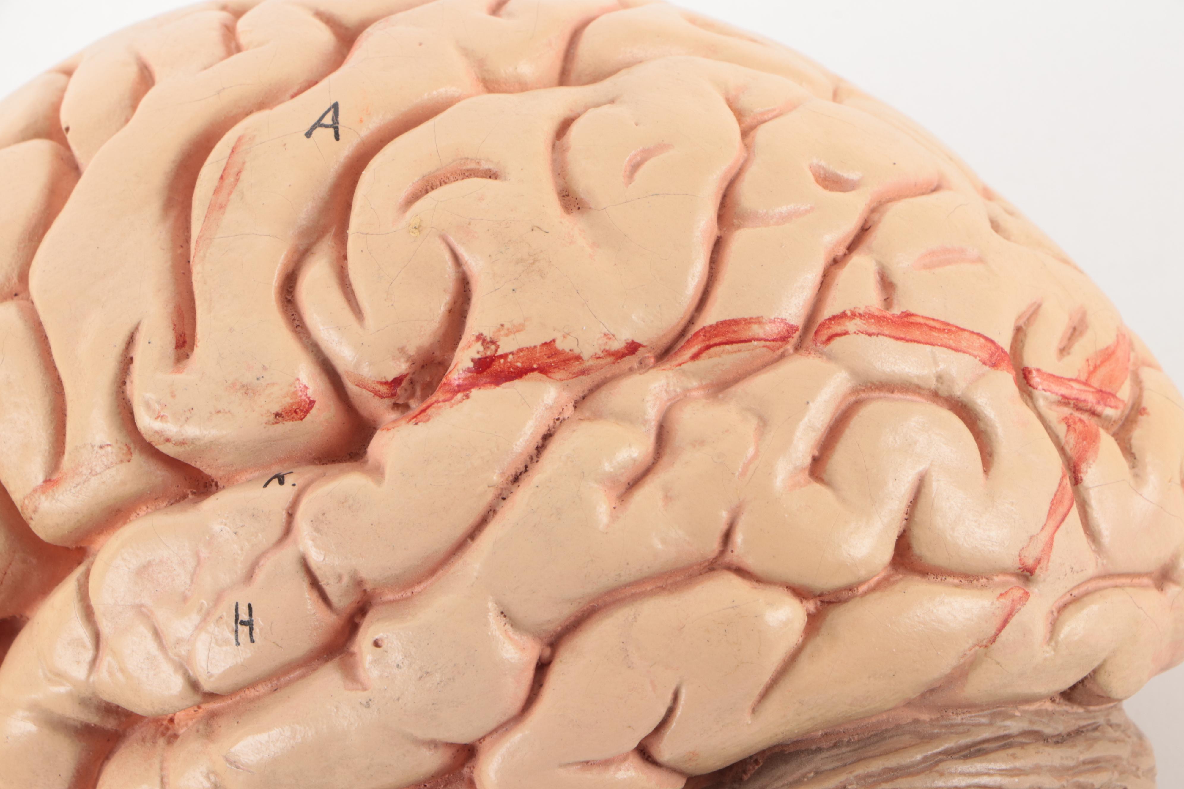 Antique Plaster Four-Piece Anatomical Model of the Human Brain ...
