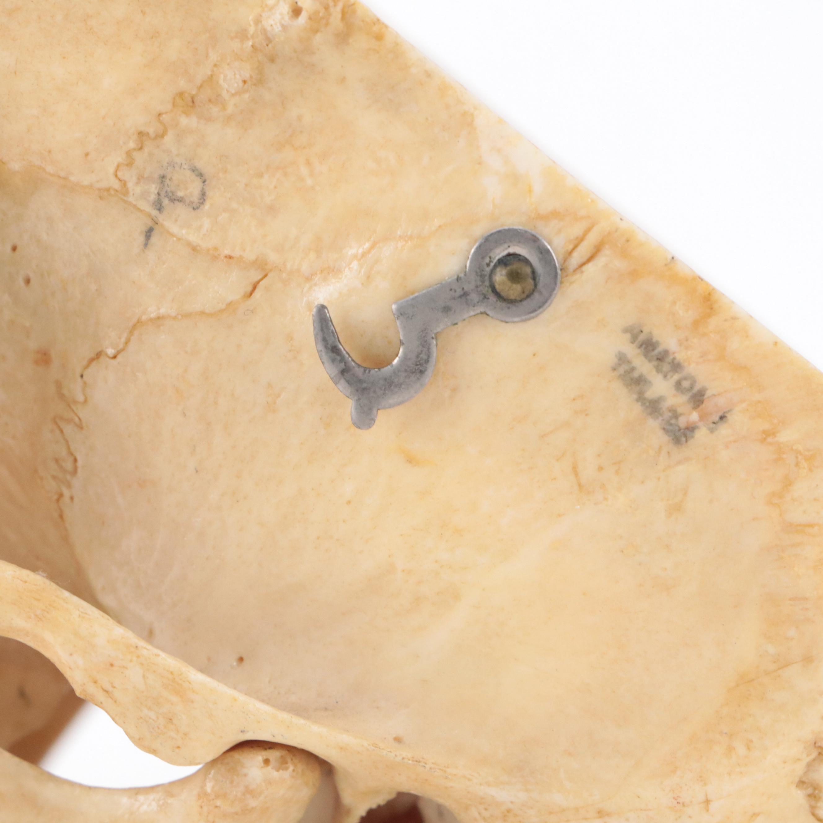 Tulane University Partial Human Skull and French Shoulder Medical ...