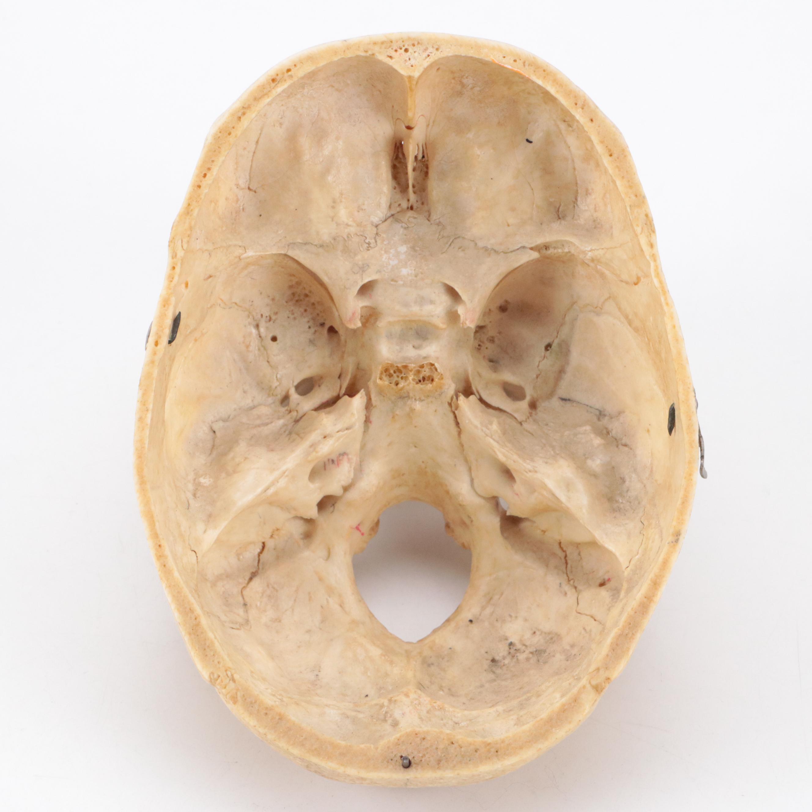 Tulane University Partial Human Skull and French Shoulder Medical ...