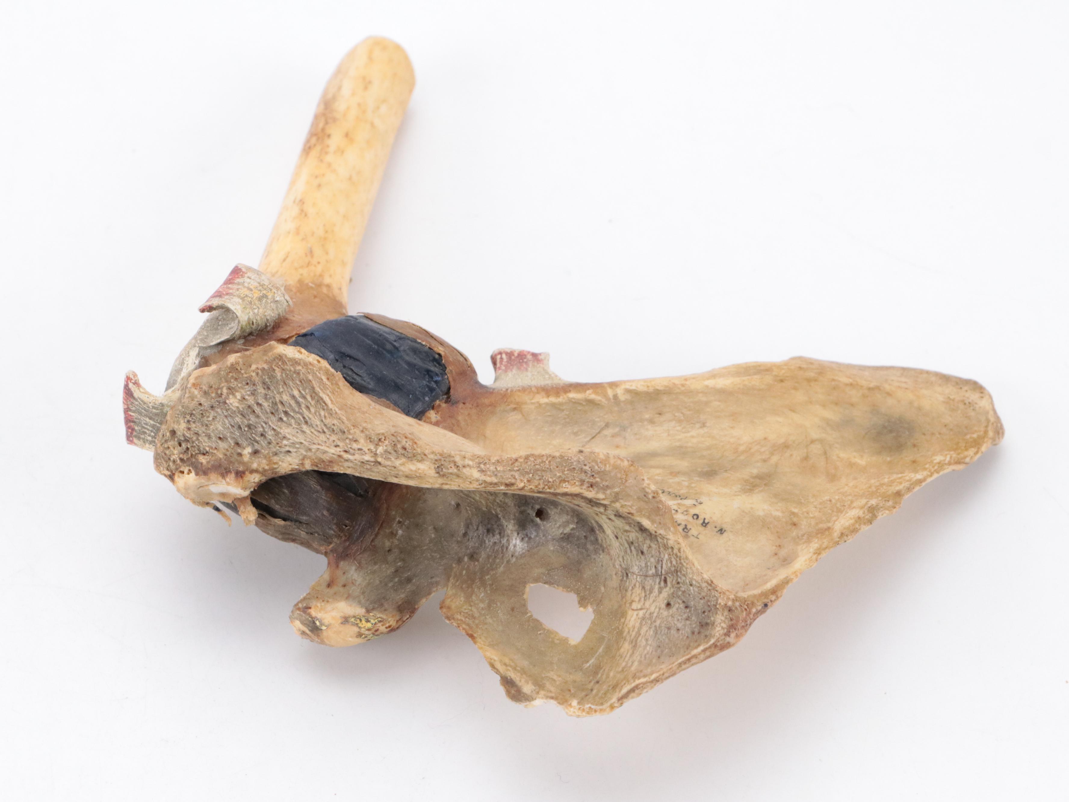 Tulane University Partial Human Skull and French Shoulder Medical ...